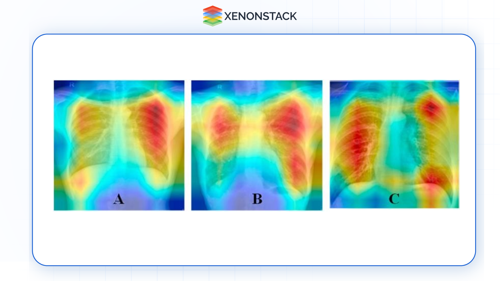 AI-Assisted Medical Imaging: Improving Diagnosis Accuracy