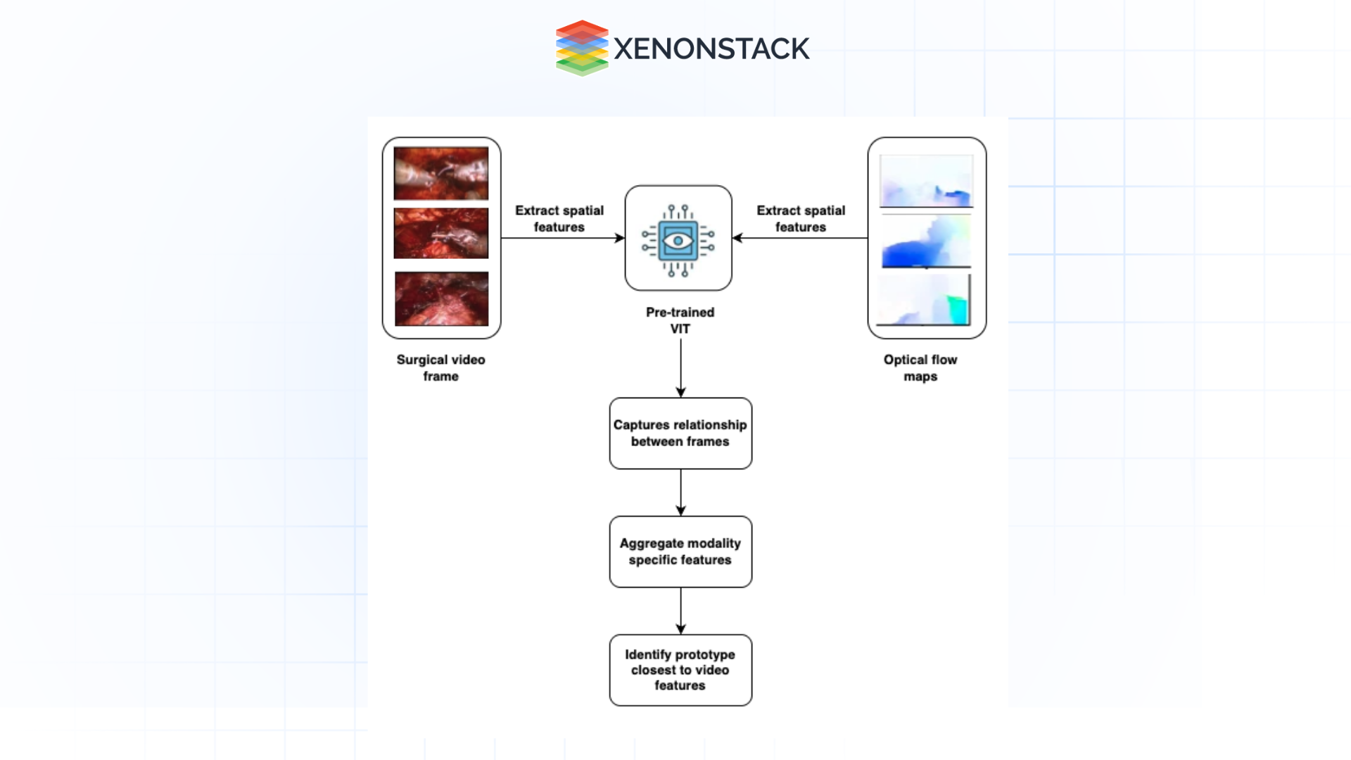 The Role of Computer Vision in Surgery Assistance and Monitoring